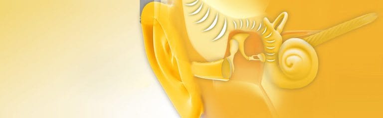 Bone Anchored Hearing Systems - The Hearing Centre - Leicester Audiologists